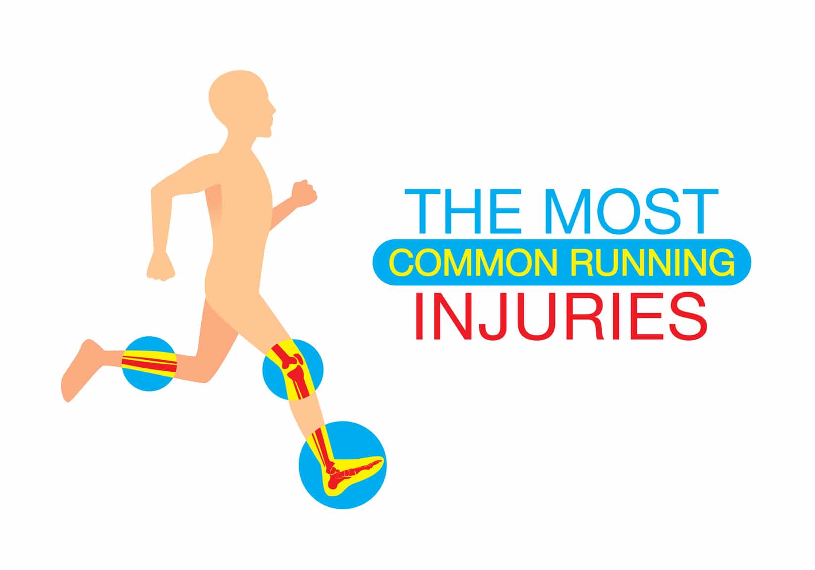 Top 10 Most Common Running Injuries - Treatment & Prevention — Runners ... Top 10 Most Common Running Injuries - Treatment & Prevention — Runners ...